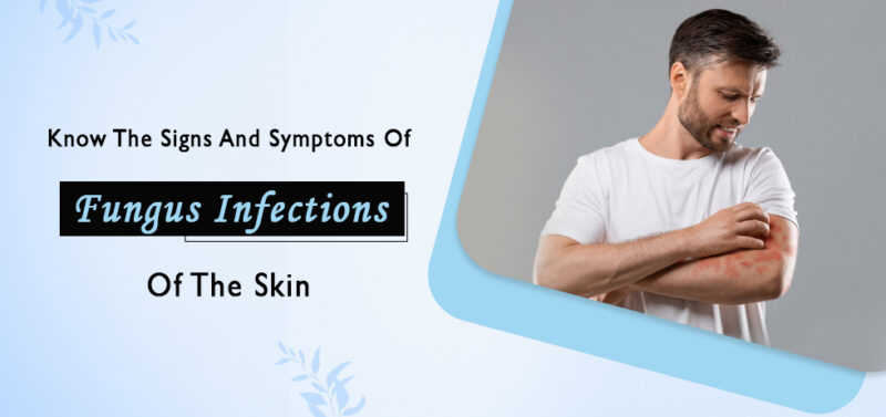 Skin : Symptoms Of A Fungus Infection